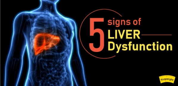5 Signs of Liver Dysfunction | Possible